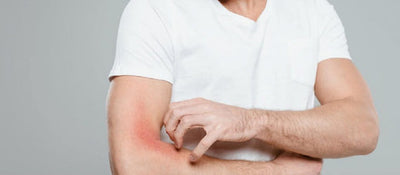 What is Neuropathic Itch?